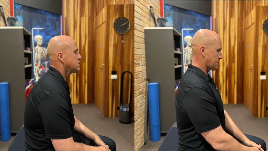 Straight Neck Posture - Hawker Place Physiotherapy and Pilates